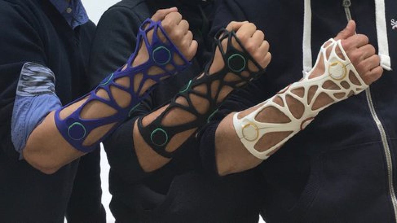 Xkelet, el invento español que sustituirá las escayolas de yeso por ...