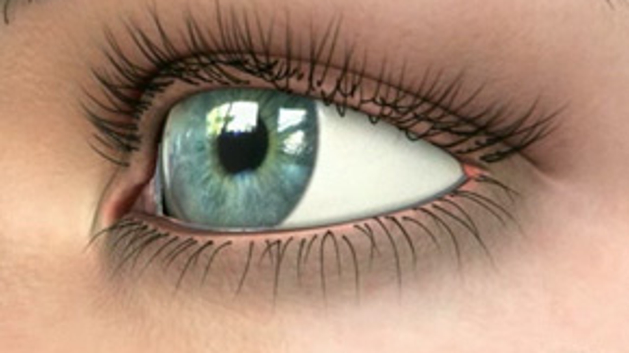 El Glaucoma La Principal Causa De Ceguera Irreversible En El Mundo