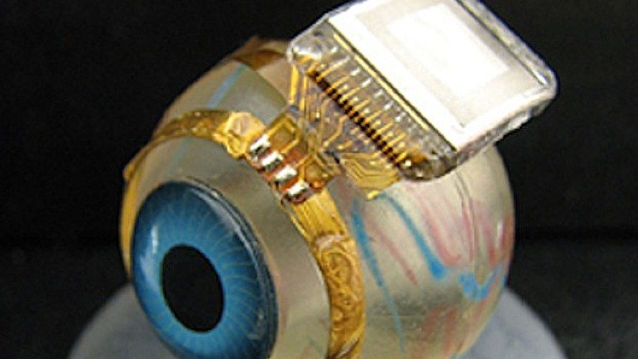 Diseñan un ojo artificial que imita el funcionamiento de la visión ...