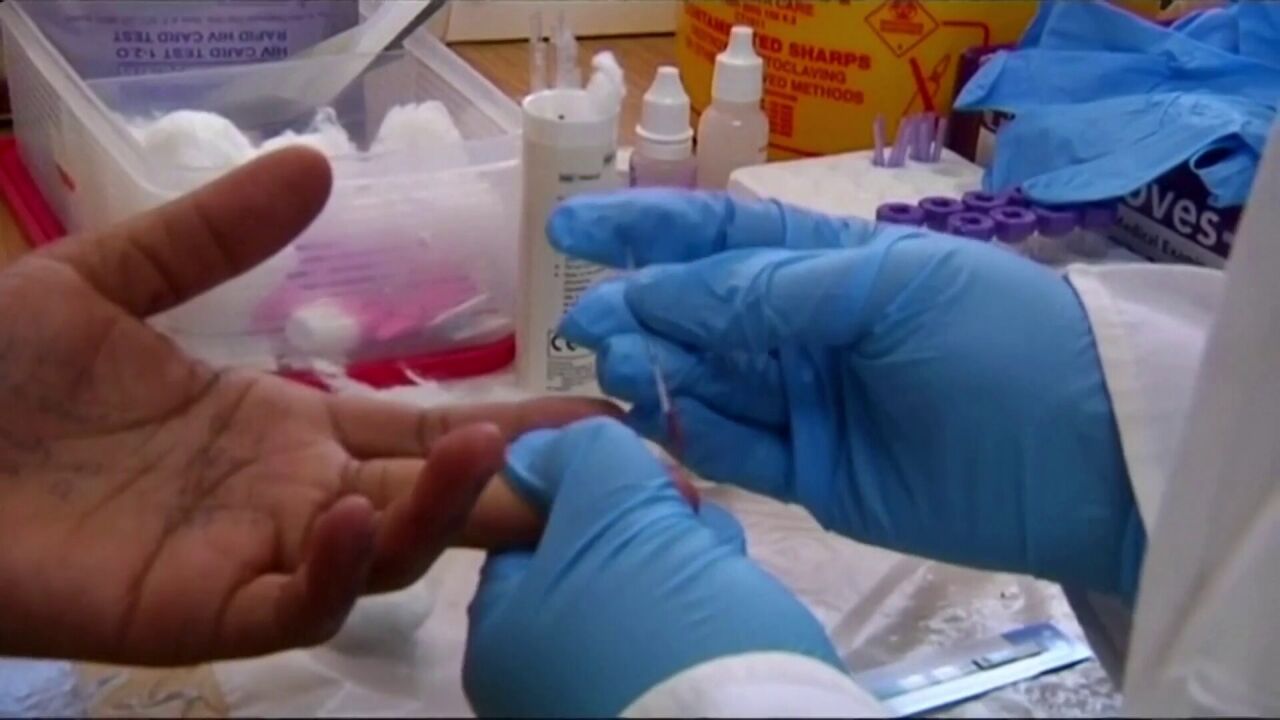 Investigadores en EEUU logran curar a la primera mujer con VIH