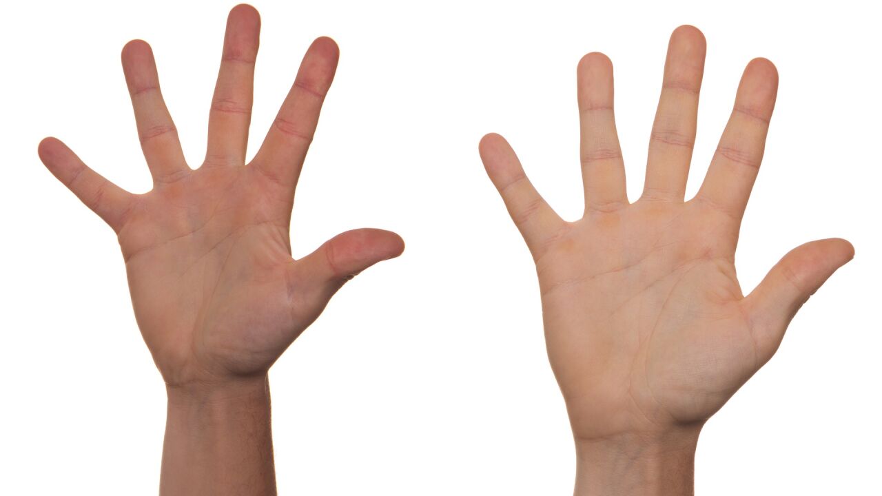 ¿Qué es el palmar largo, el músculo que ha perdido el 15% de la población?