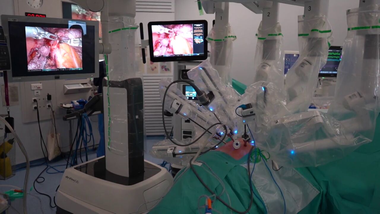 El Hospital Vall d'Hebron realiza el primer trasplante pulmonar ...