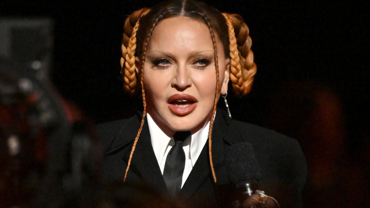 ¿Qué es el pillow face o cara hinchada de algunas famosas?