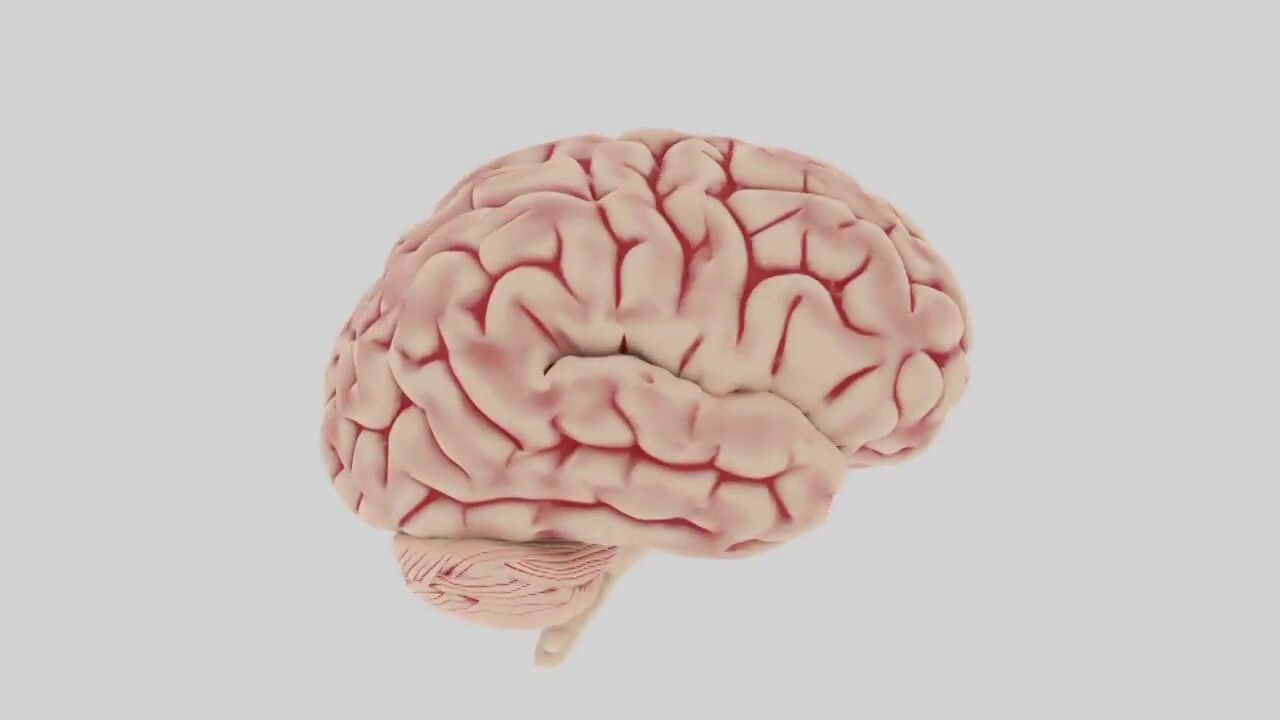 Una técnica novedosa con electrodos en el cerebro ayuda a reducir los ...