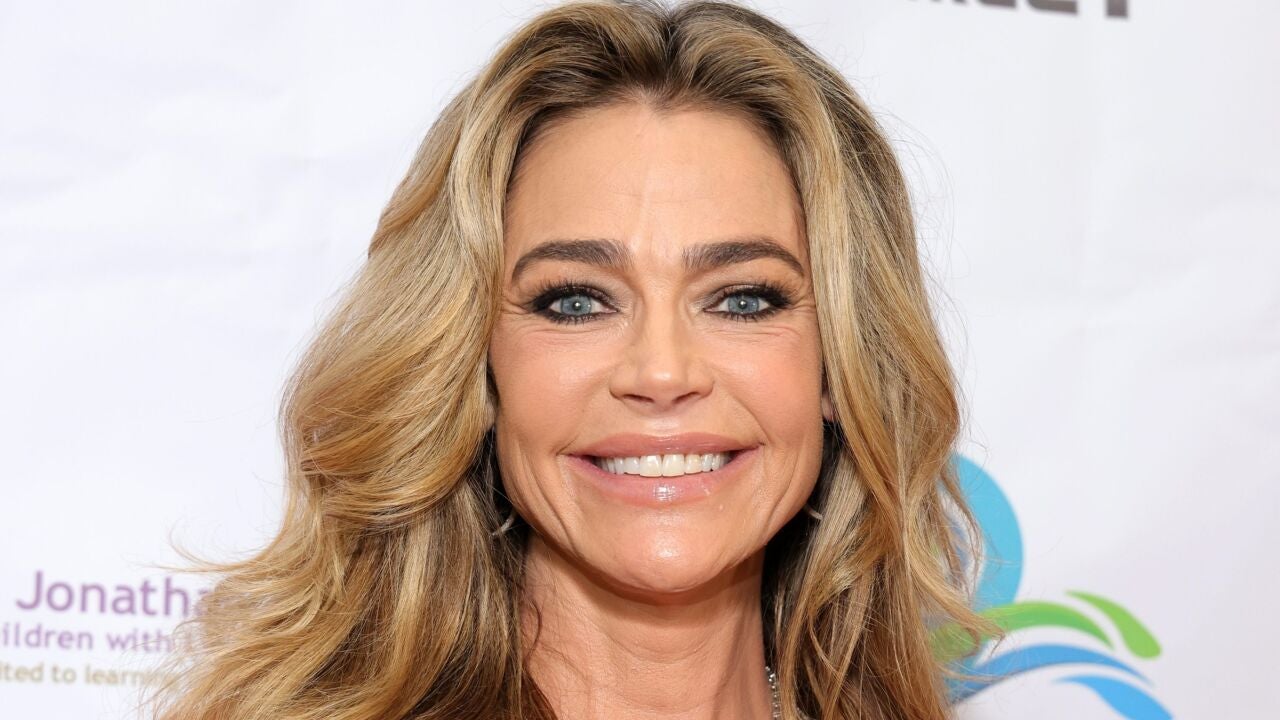 Denise Richards muestra el antes y el después tras hacerse un lifting ...
