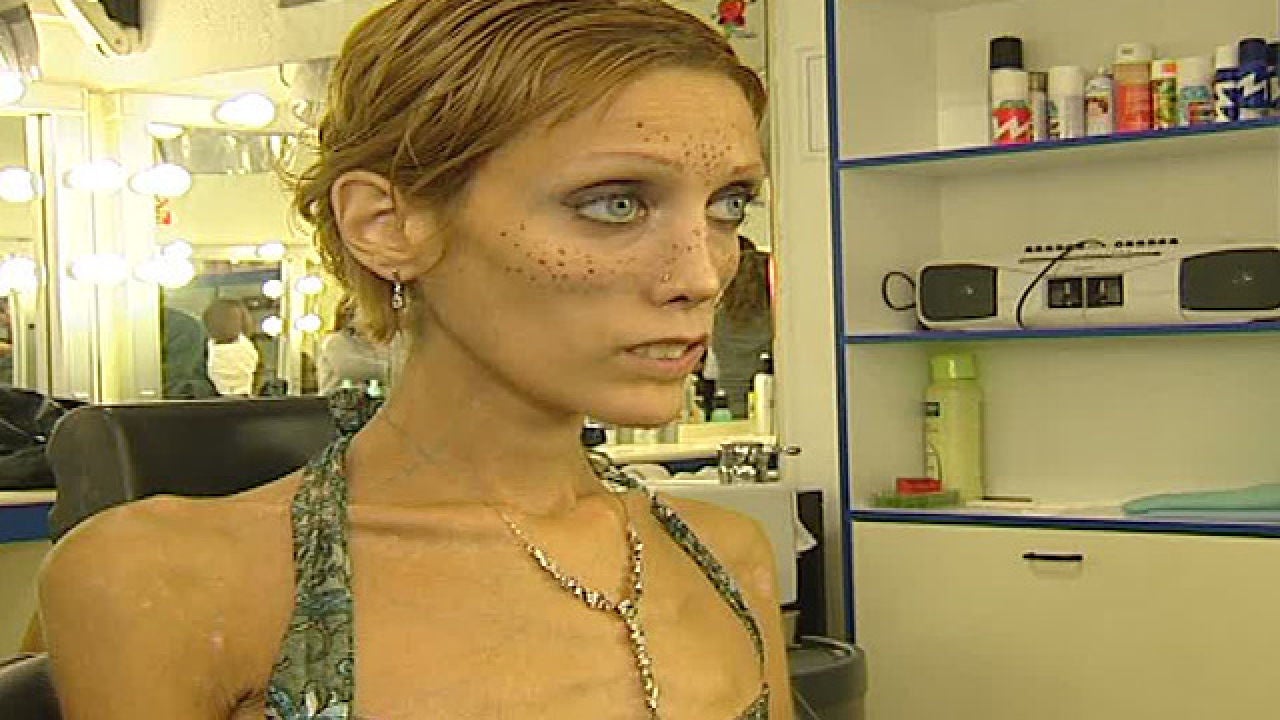 Muere Isabelle Caro, la 'musa anoréxica' de Oliviero Toscani