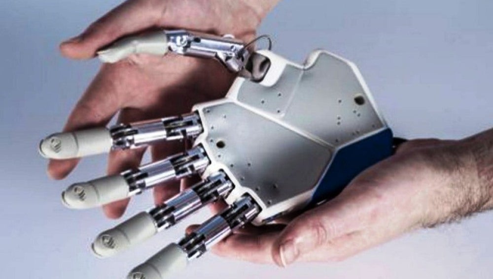La primera mano biónica capaz de sentir será trasplantada a finales de año