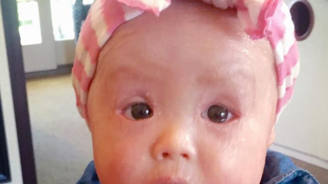 El milagro de Harper, una niña con escamas en la piel que sobrevivió ...