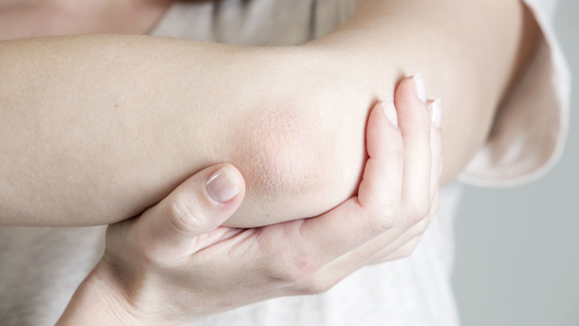 Cómo evitar que se te oscurezcan los codos y rodillas