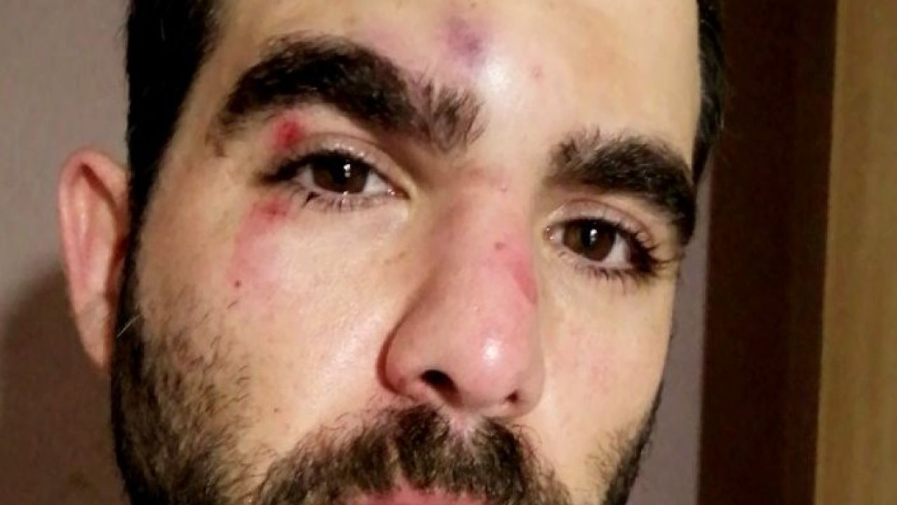 Barcelona: Pegan una paliza al periodista Robert Calvo en el Raval