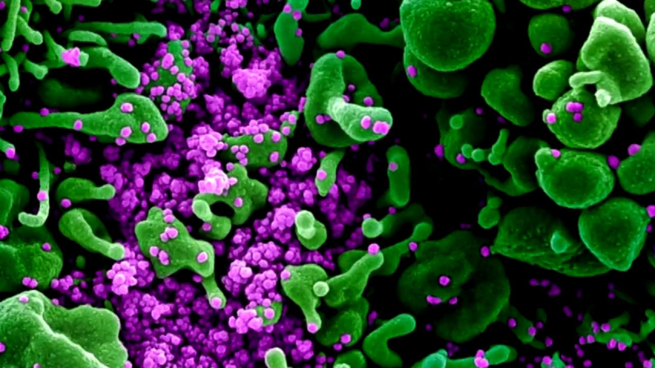 Científicos japoneses identifican el virus Yezo, un nairovirus que ...