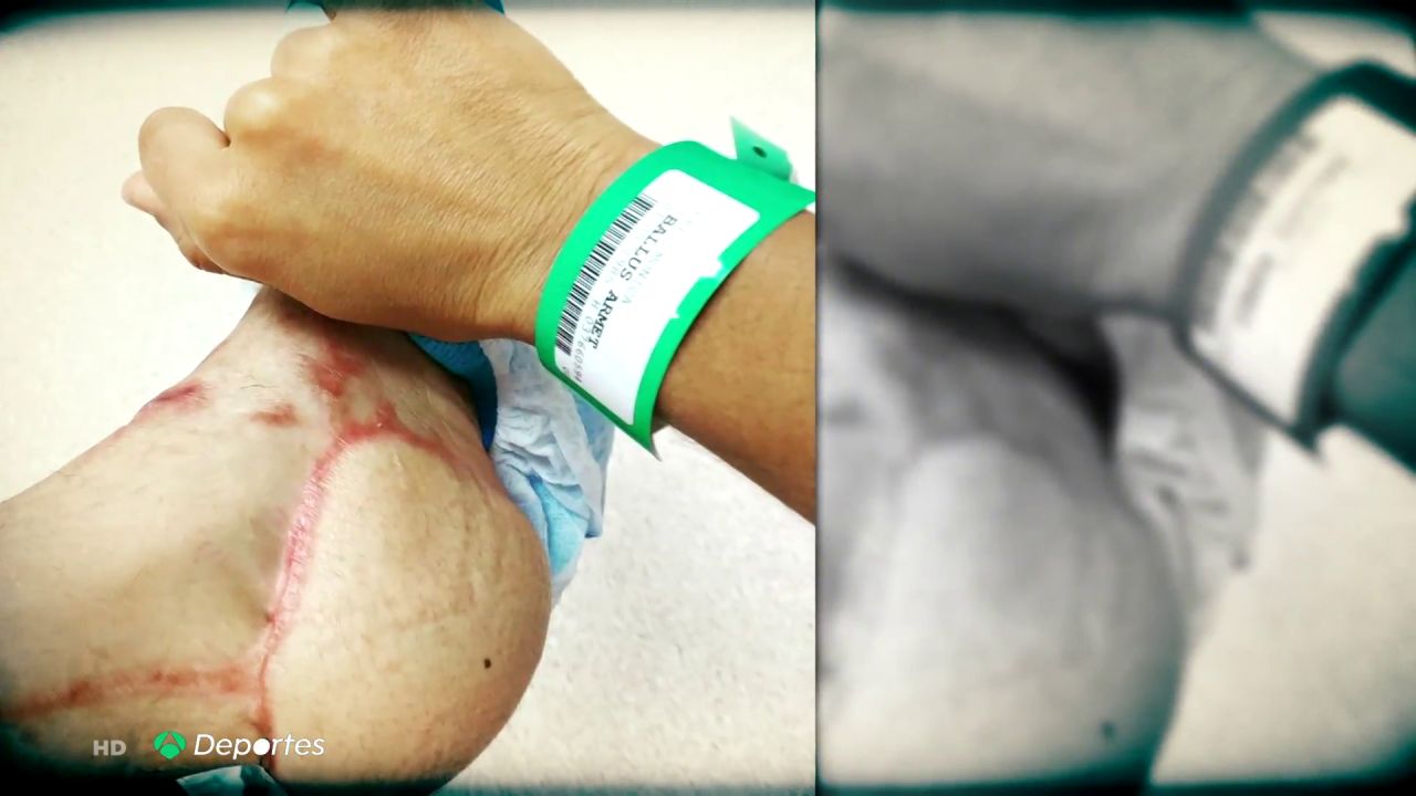 La historia de superación de la kitesurfista Mónica Ballús tras un ...