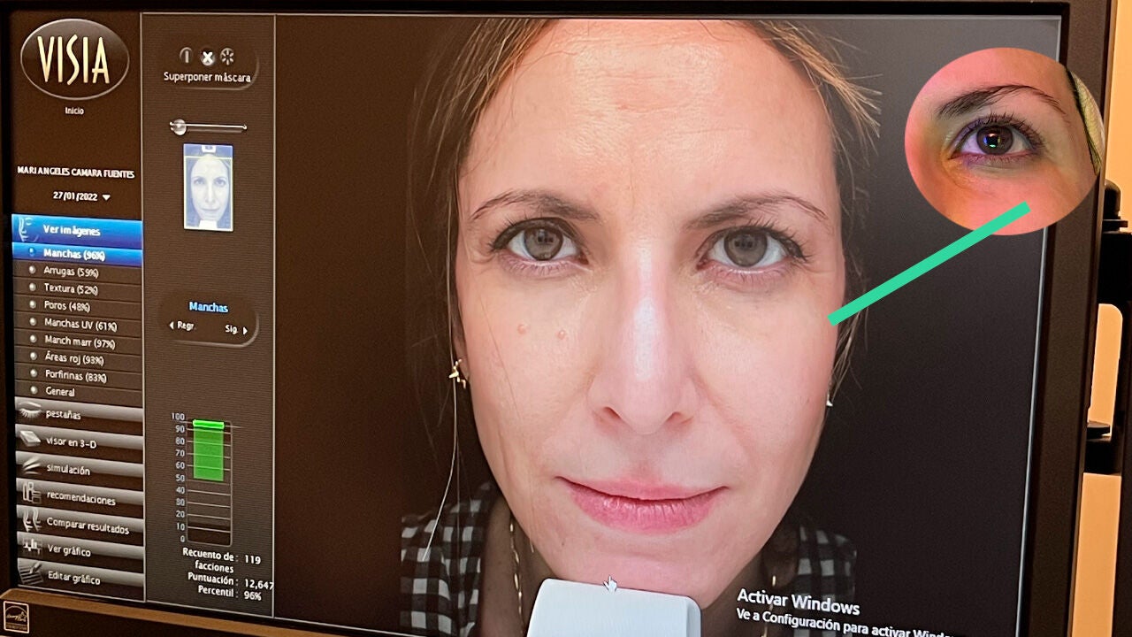 Probamos Symmed Elite, lo último en tratamientos para quitarte años de ...