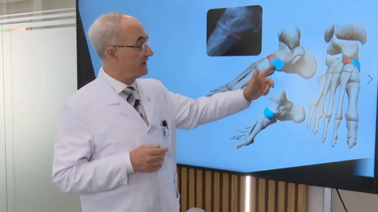 Qué es el síndrome de Müller-Weiss, la lesión crónica que sufre Rafa ...