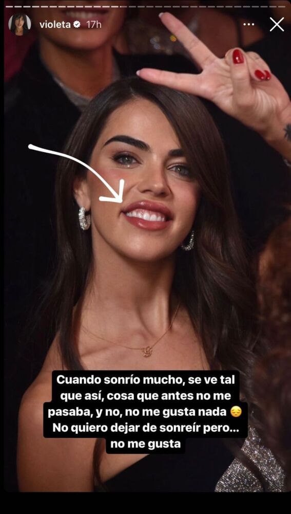 Carla Barber tiene la solución a la "rara" sonrisa que se nota Violeta Mangriñán