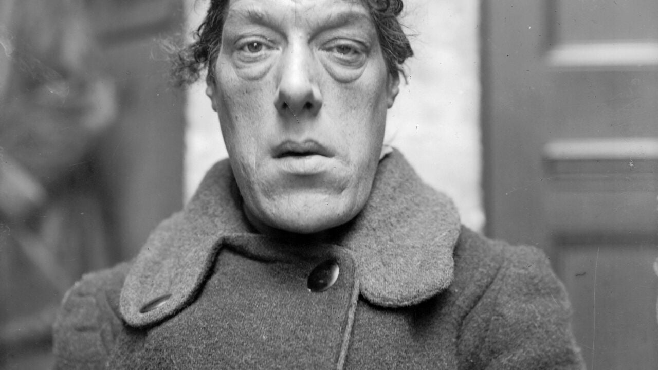 La dura historia de la mujer "más fea del mundo" para poder criar a sus ...