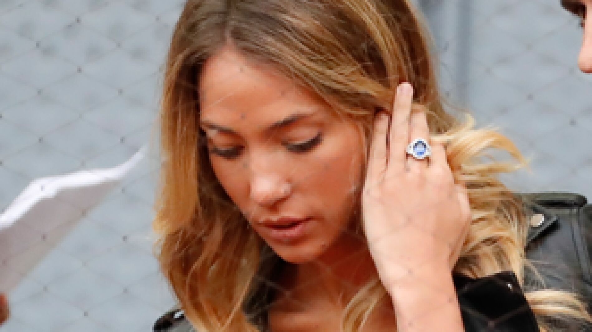 Alice Campello muestra cómo casi ha conseguido eliminar las marcas que ...