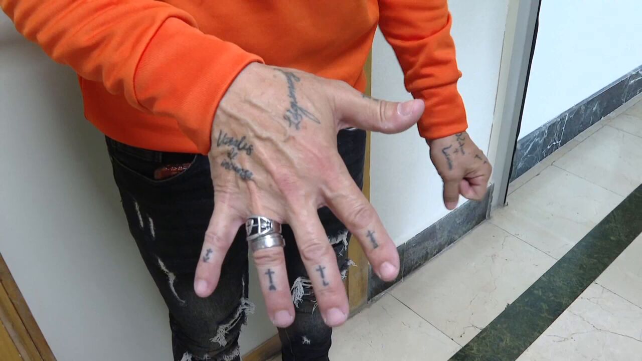 Luis se tatúa en honor a las cirujanas que le salvaron la vida tras una ...