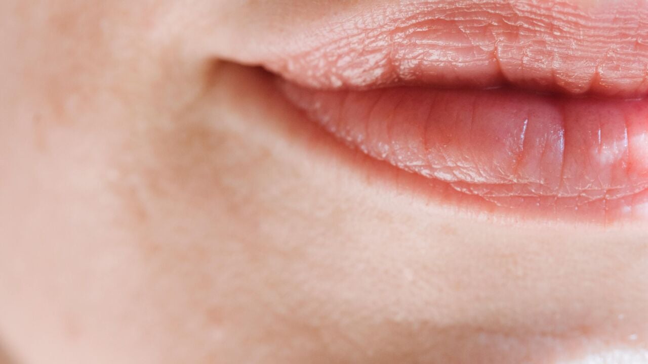 ¿Es verdad que si comes algo con asco te puede salir una pupa?
