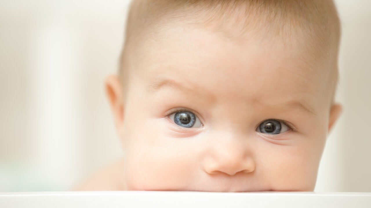 ¿Qué es el pliegue de Dennie-Morgan? La arruga que puede alertar sobre ...