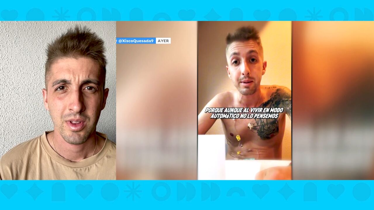 La historia de superación de Xisco Quesada, un joven con cáncer de hígado que llena las redes de ...