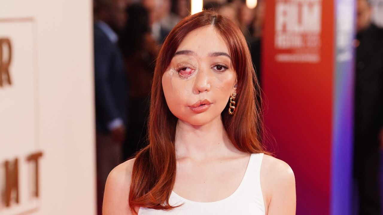 Nikki Lilly, la influencer que ha convertido su enfermedad en una ...